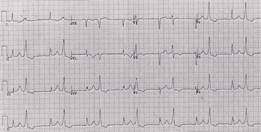 EKG 12 Lead Analysis and Interpretation Practice Quiz