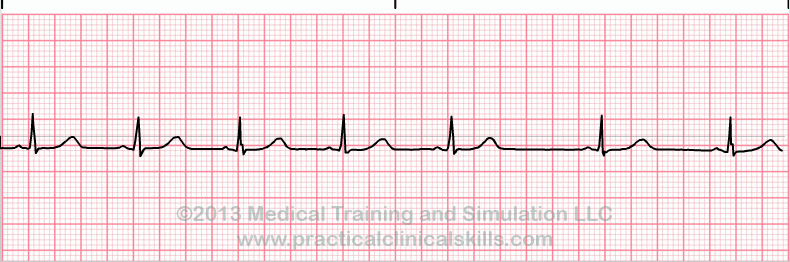 EKG Practice Drill