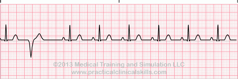 EKG Practice Drill