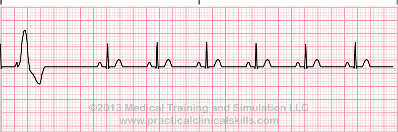 ECG Practice Drill