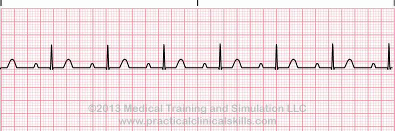 EKG Practice Drill
