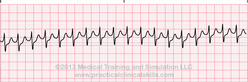 EKG Practice Drill