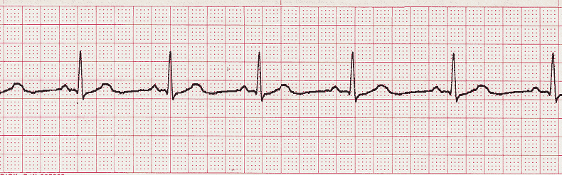 Comprehensive ECG Quiz | Multiple Choice Graded Quiz